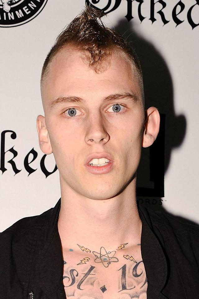 All About Machine Gun Kelly Hair Transplant - Hairfix