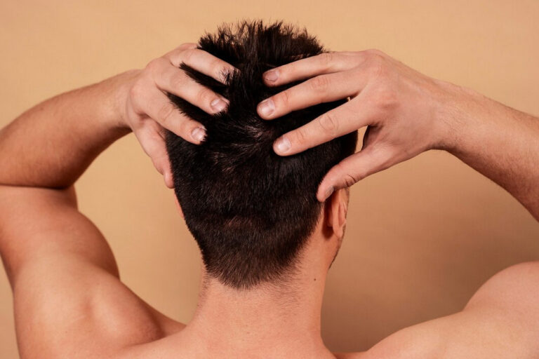 Scalp areas in hair transplant - Hairfix