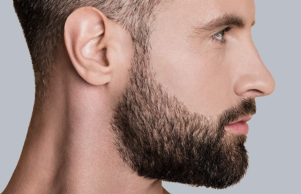 Hair Transplant in Tijuana, Mexico | HairFix